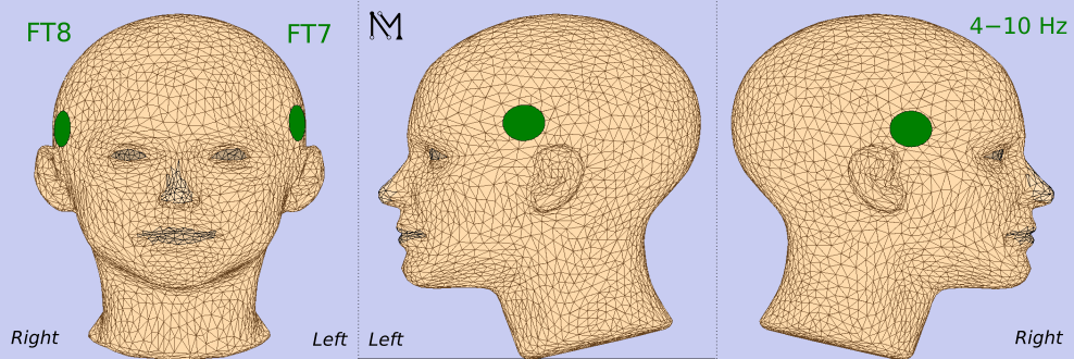 Understanding tDCS Electrode Placement: A Guide | tDCS Devices